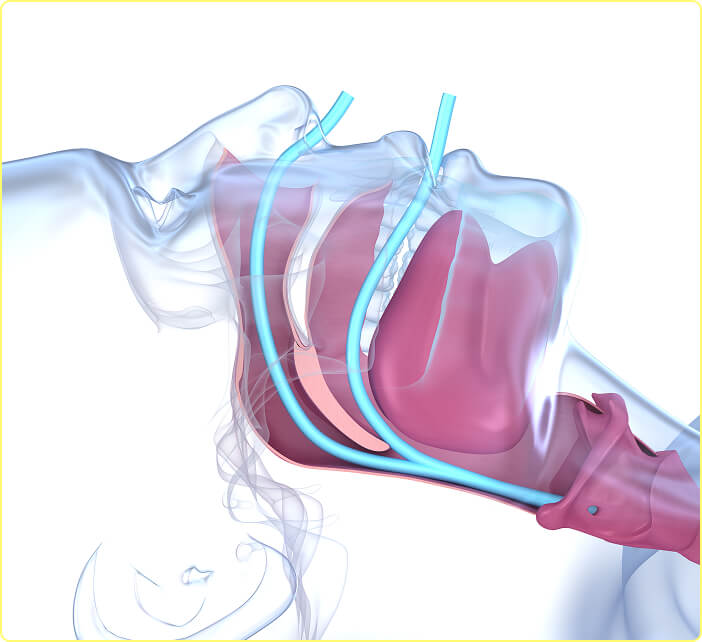 Treatments | 5280 Orthodontics